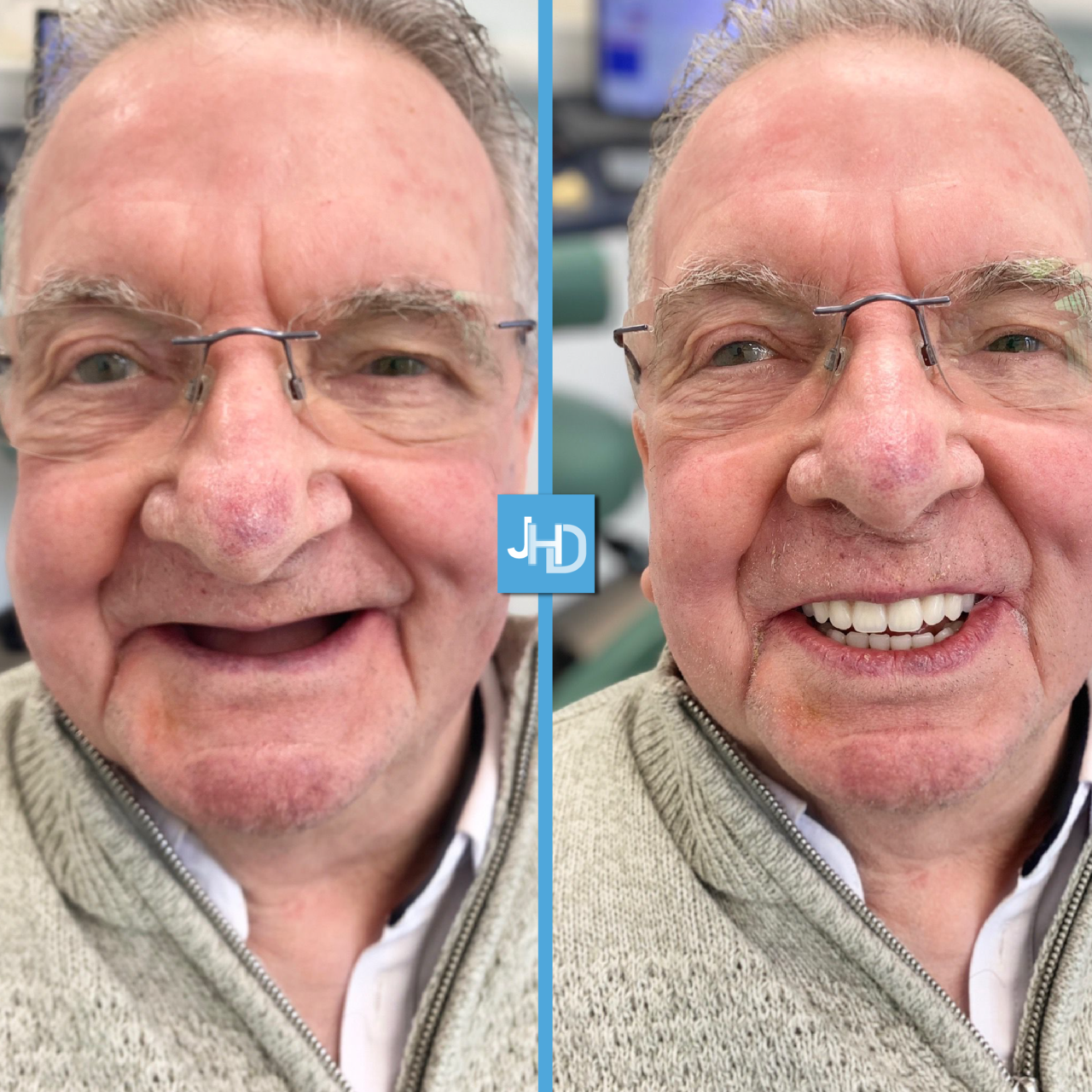 John Holmes | Dental Implants Swaffham, Kings Lynn Norfolk