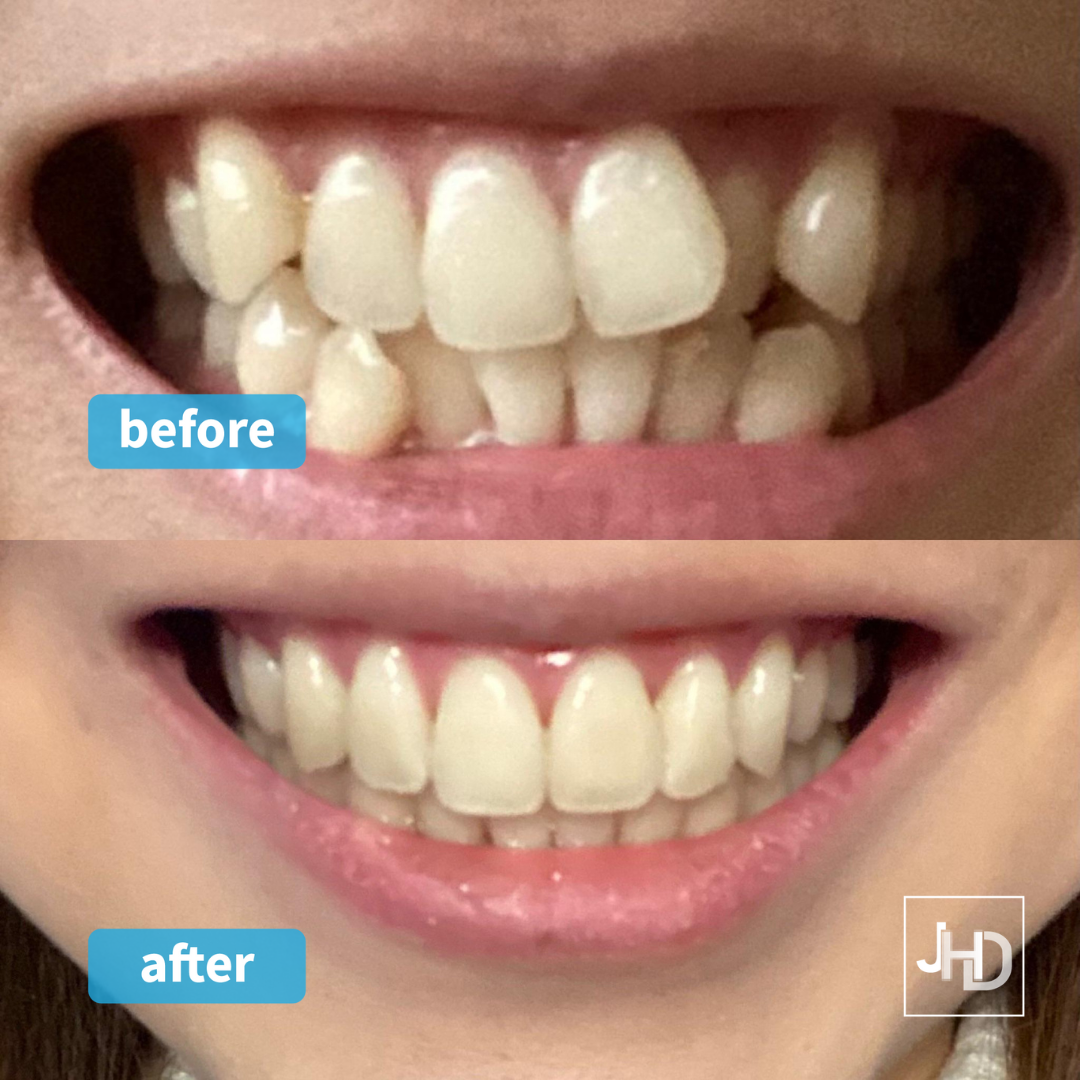 John Holmes | Invisalign Open Day in Kings Lynn and Norfolk