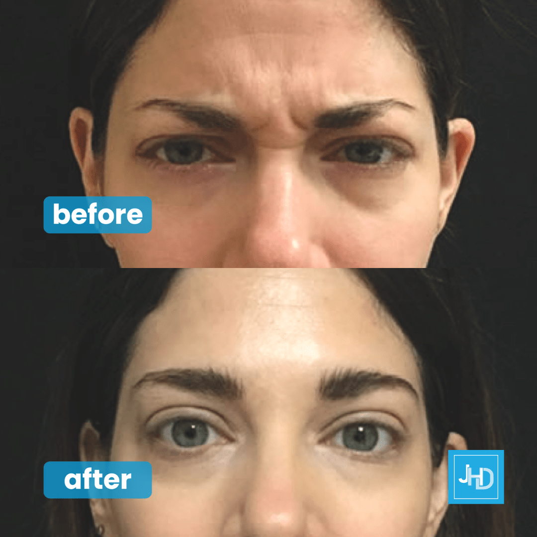 John Holmes Dental | Facial Aesthetics Lip & Anti-Wrinkle Swaffham ...
